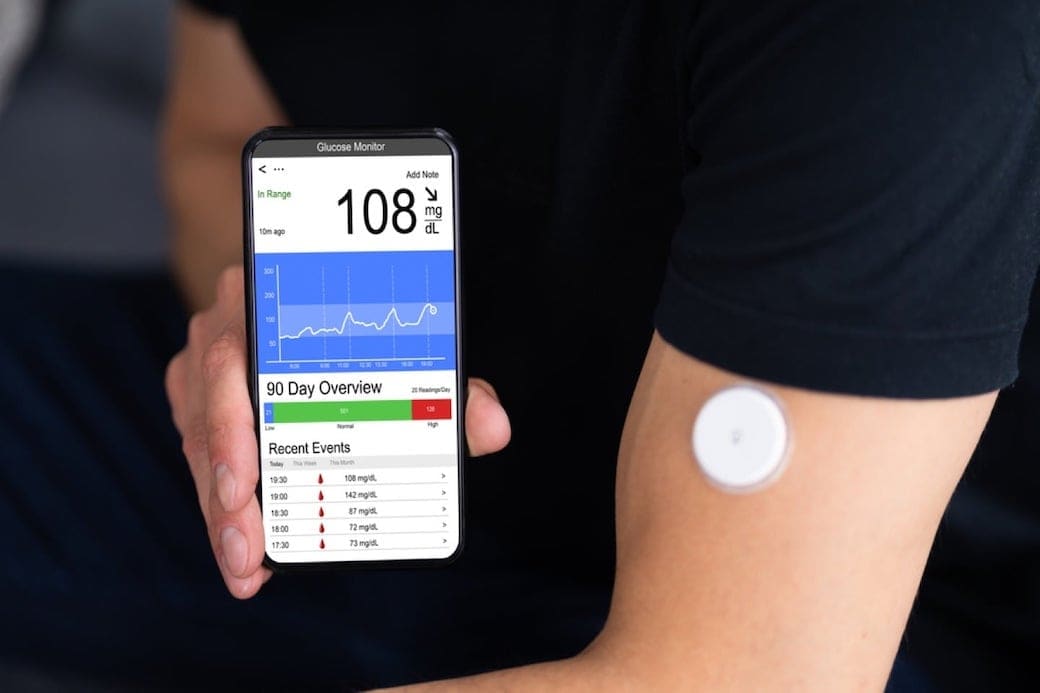 Continuous Glucose Monitoring CGM